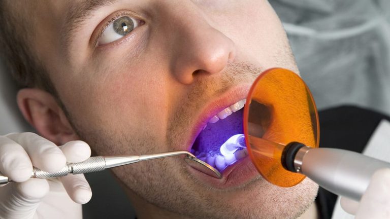 LANAP® Laser Periodontal Surgery – Periodontal Associates Inc